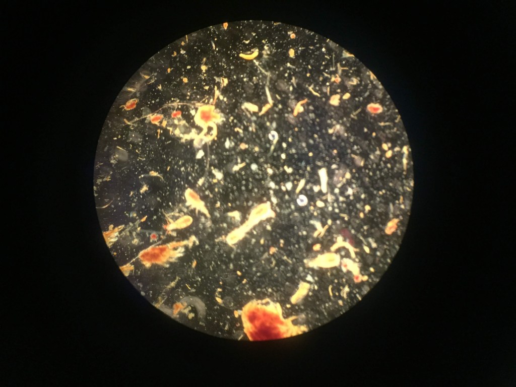 Staphylococcus aureus Under Microscope – Joshua Wilson