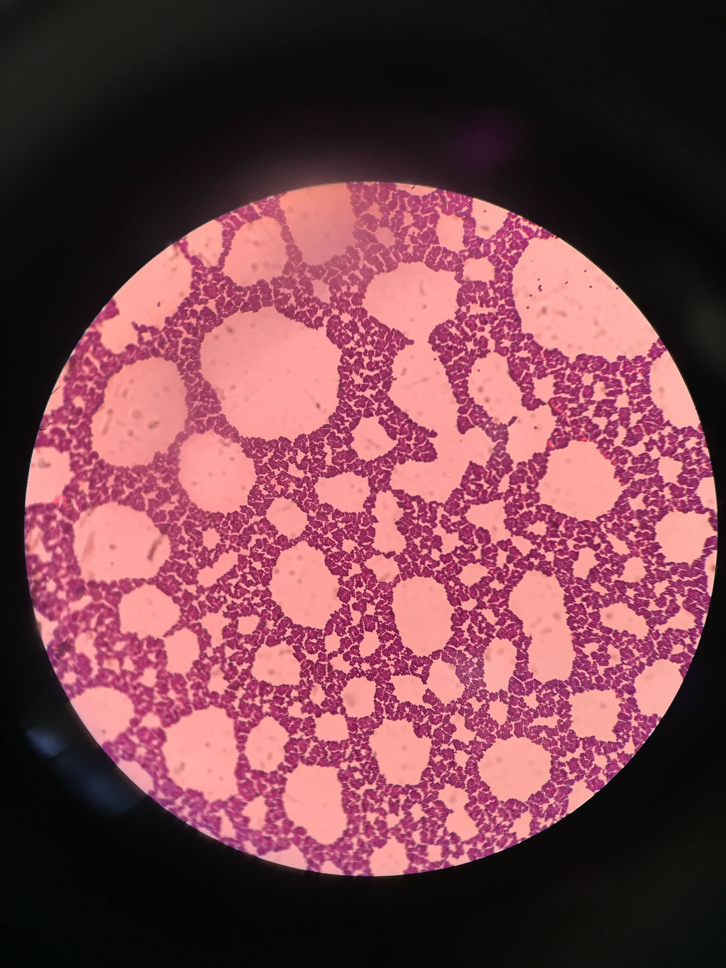 Staphylococcus aureus Under Microscope – Joshua Wilson