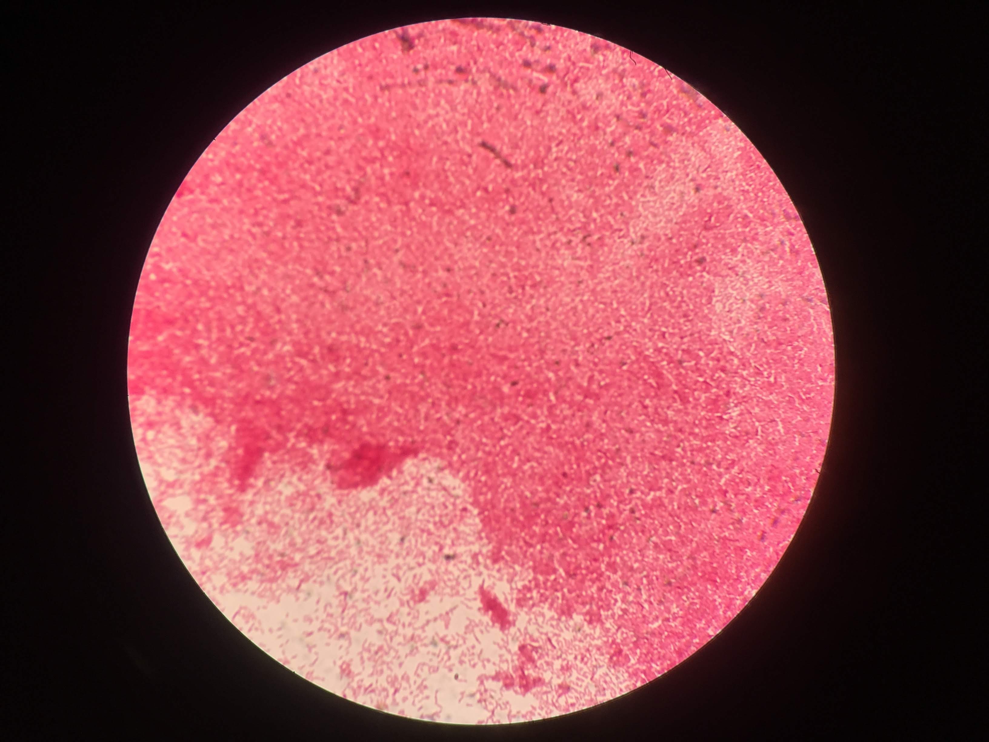 Staphylococcus aureus Under Microscope – Joshua Wilson