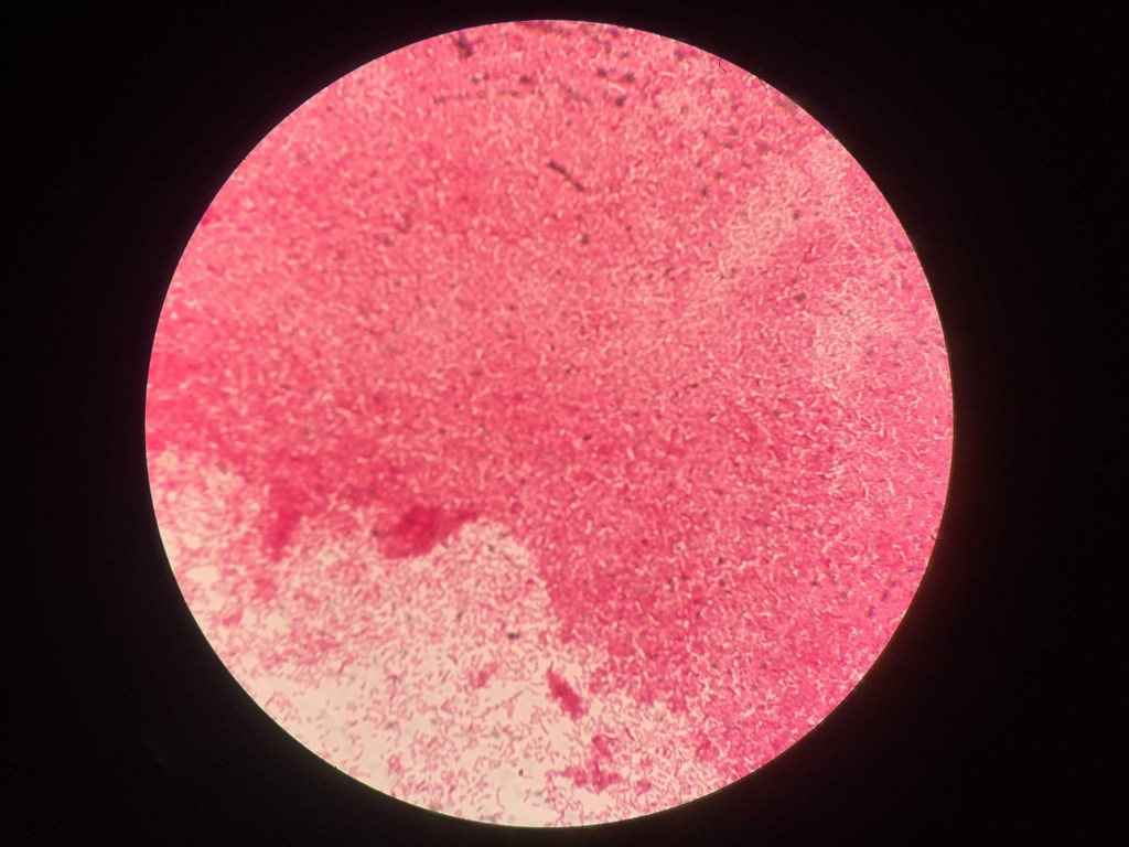 Staphylococcus aureus Under Microscope – Joshua Wilson